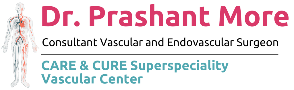 Dr Prashant More – Vascular Surgeon in Aurangabad